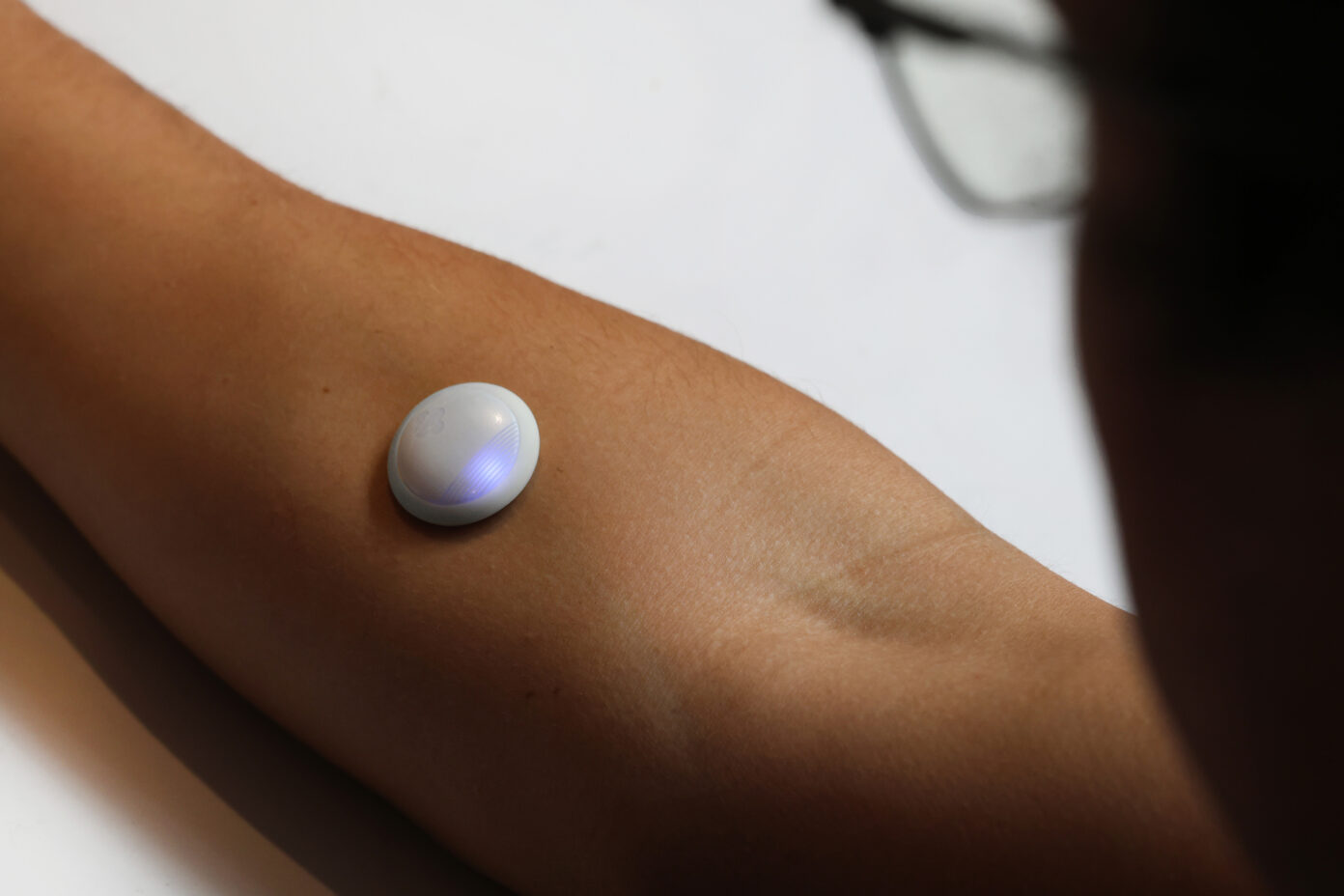 Biolinq Shine: A New Generation Glucose Sensor - MedScriptum