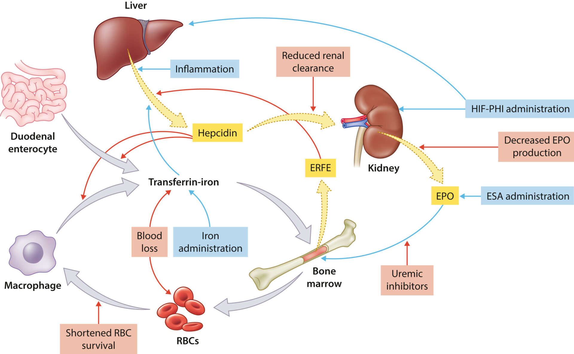 KDIGO 2026 Guideline: Anemia in Chronic Kidney Disease - MedScriptum